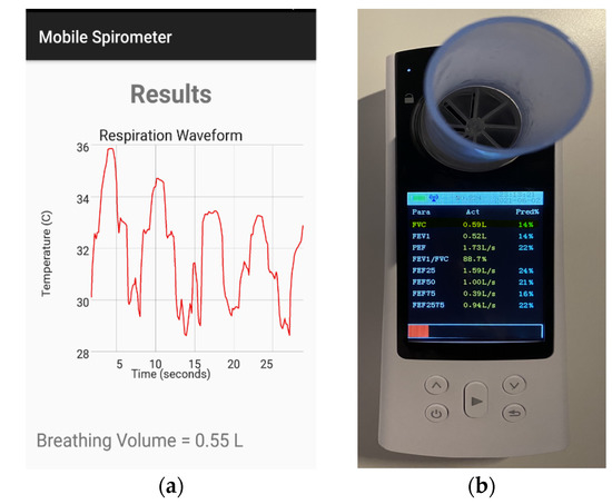 Non-Contact Spirometry Using a Mobile Thermal Camera and AI Regression