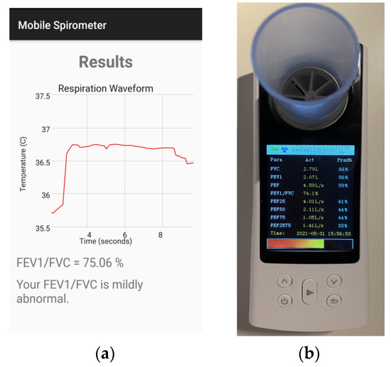 Sensors | Free Full-Text | Non-Contact Spirometry Using a Mobile ...