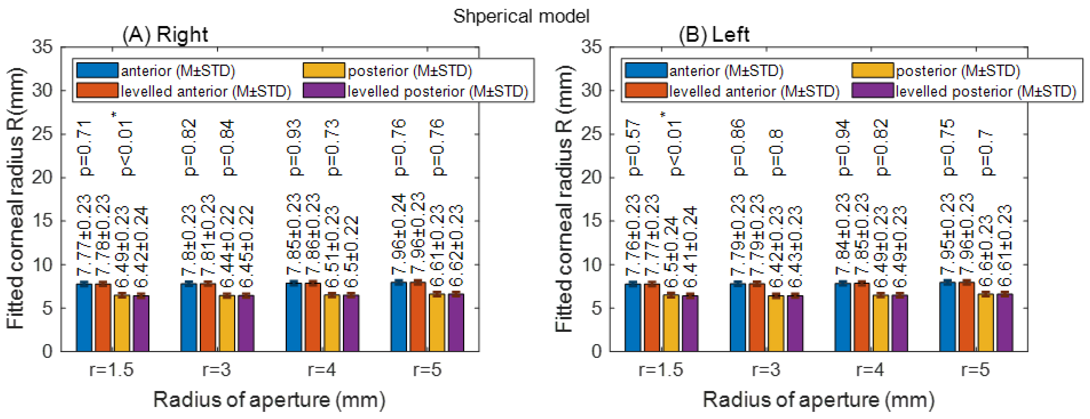Effect of Corneal Tilt on the Determination of Asphericity