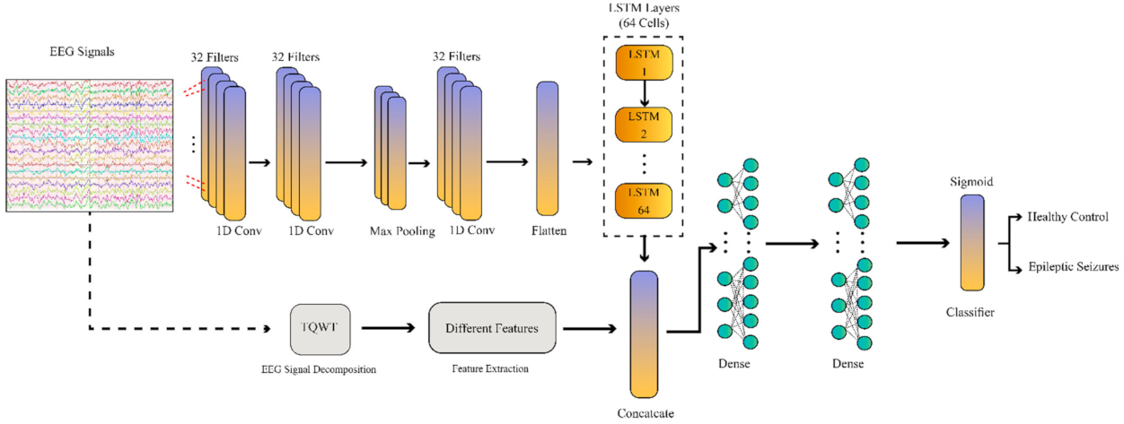 Epileptic Seizures Detection in EEG Signals Using Fusion Handcrafted ...