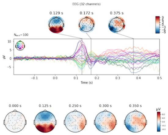 Sensors | Free Full-Text | The Influence of Filters on EEG-ERP Testing ...