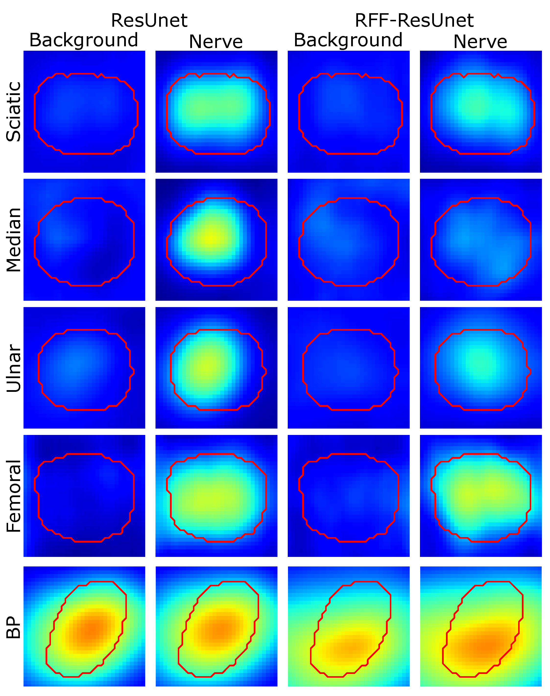 Random Fourier Features-Based Deep Learning Improvement with Class Activation Interpretability ...