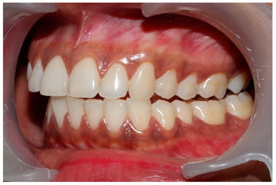 Sensors | Free Full-Text | A Multi-Center Disclusion Time Reduction ...