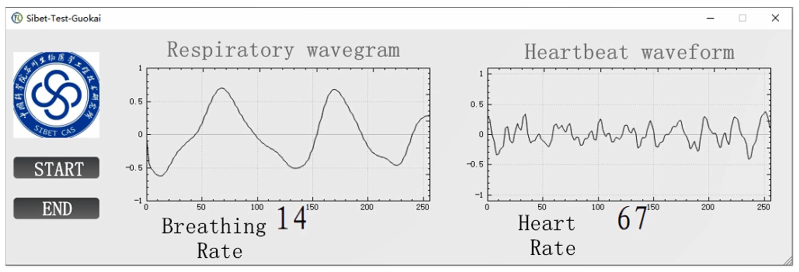 Design of a Millimeter-Wave Radar Remote Monitoring System for the ...