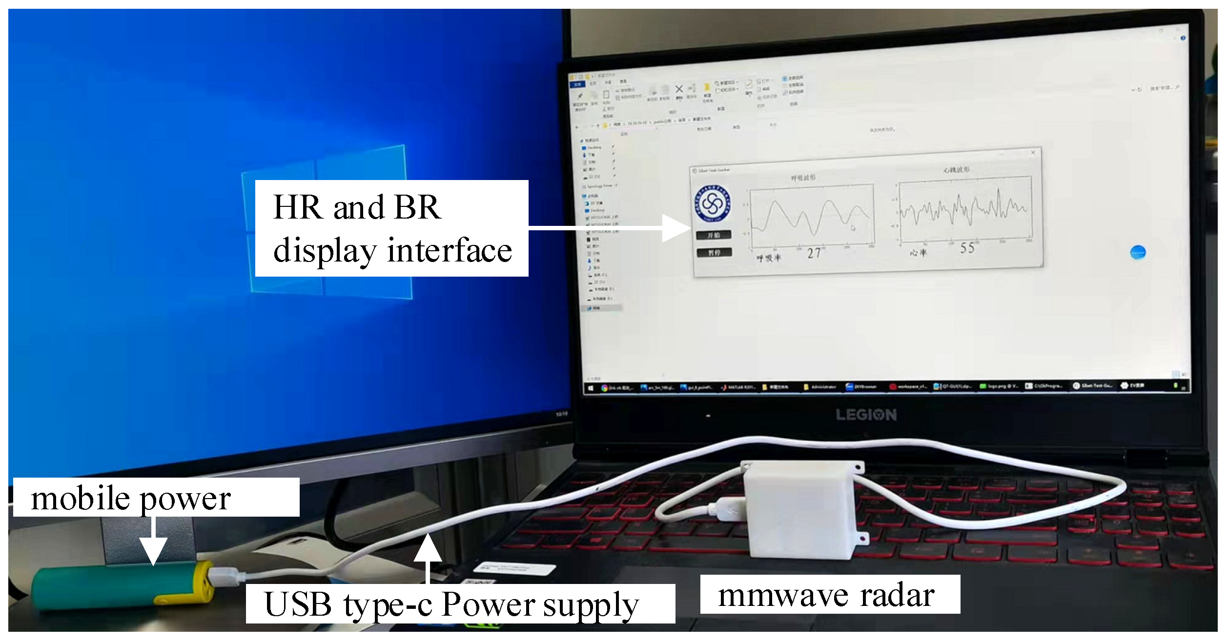 Design of a Millimeter-Wave Radar Remote Monitoring System for the ...