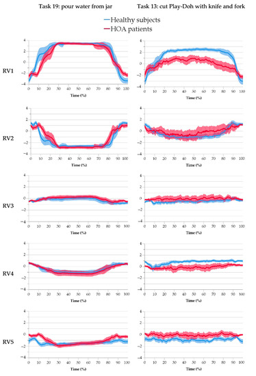 Using Sensorized Gloves and Dimensional Reduction for Hand Function ...