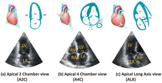 Advanced Ultrasound and Photoacoustic Imaging in Cardiology
