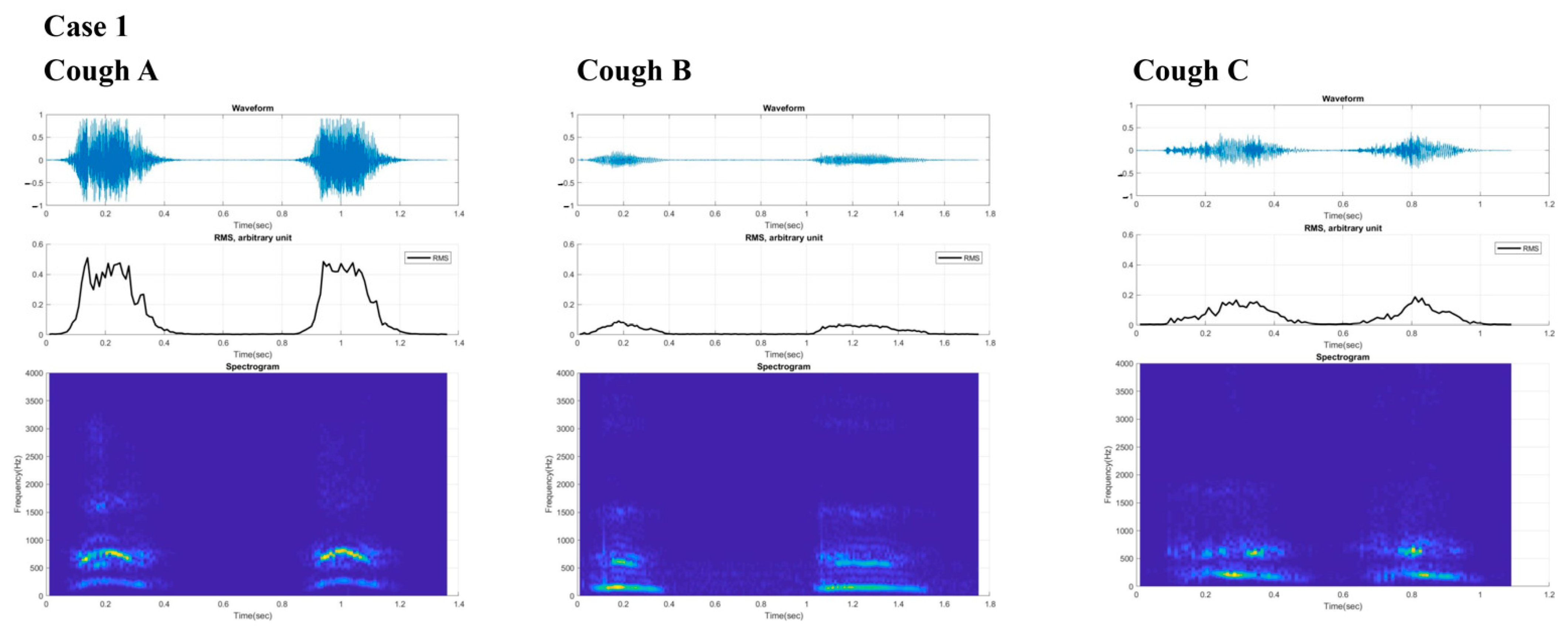 Cough Sounds Recorded via Smart Devices as Useful Non-Invasive Digital ...