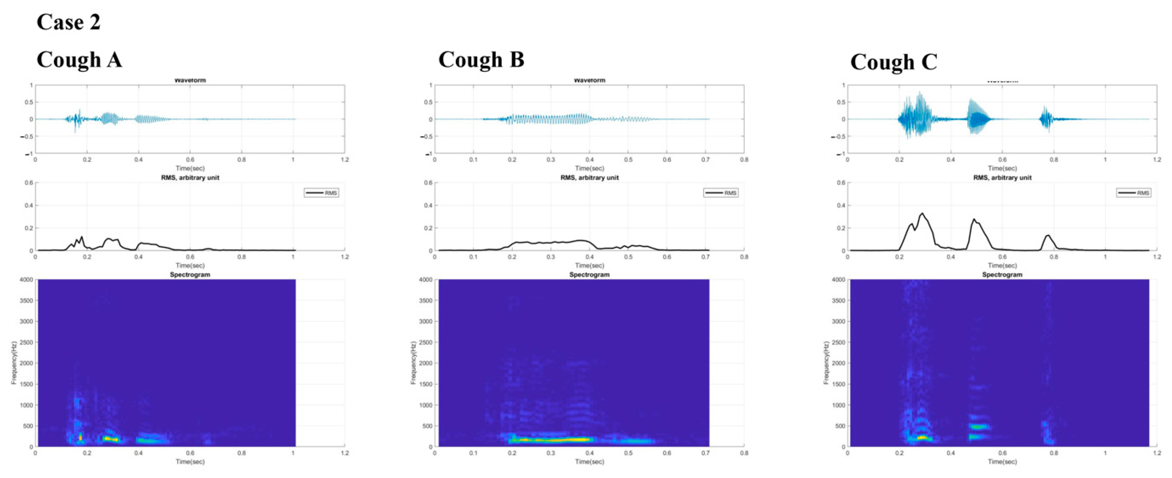 Cough Sounds Recorded via Smart Devices as Useful Non-Invasive Digital ...
