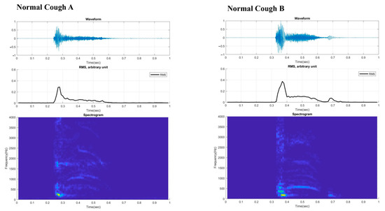Cough Sounds Recorded via Smart Devices as Useful Non-Invasive Digital ...