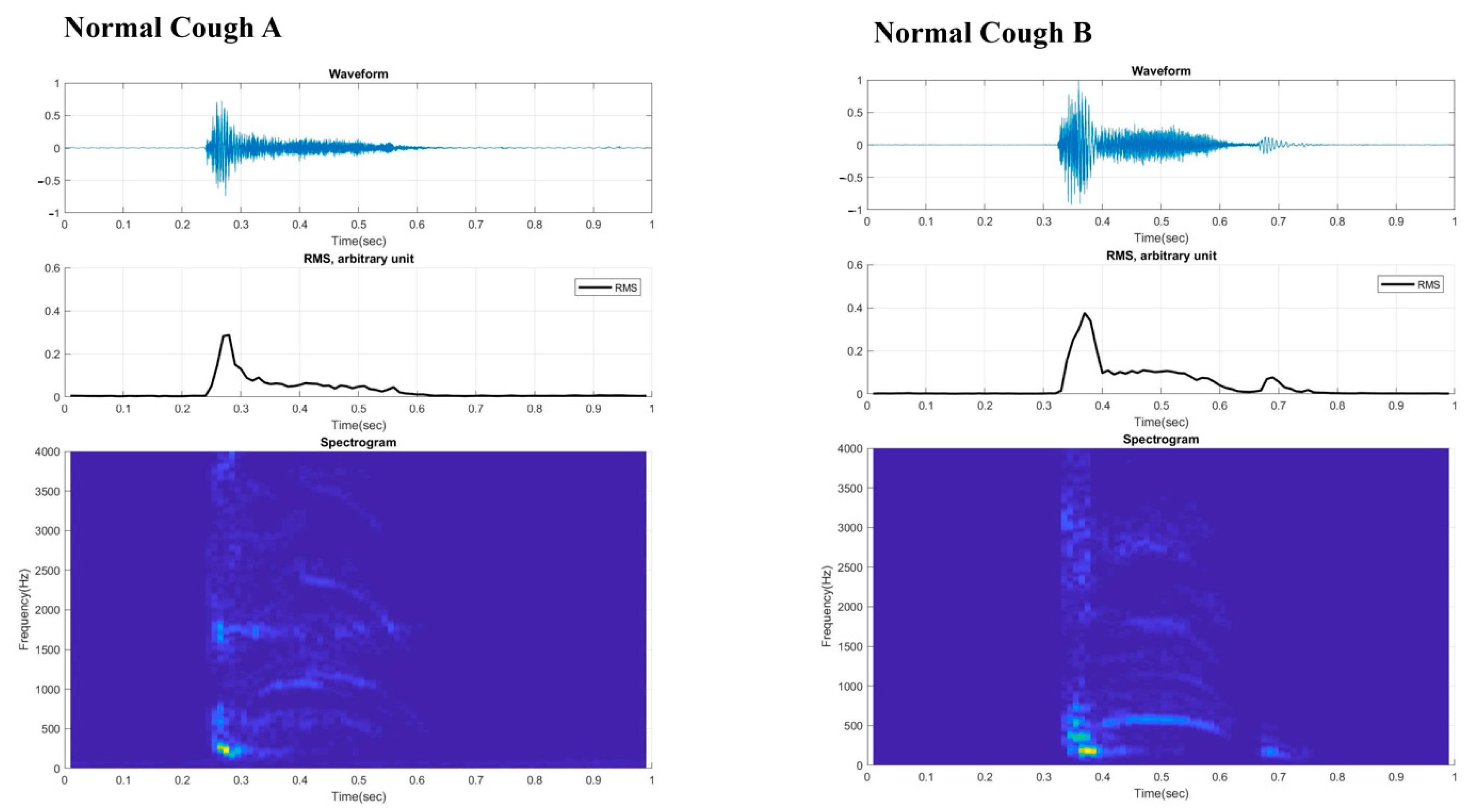 Cough Sounds Recorded via Smart Devices as Useful Non-Invasive Digital ...