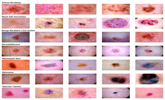 Deep Learning-Based Transfer Learning for Classification of Skin Cancer