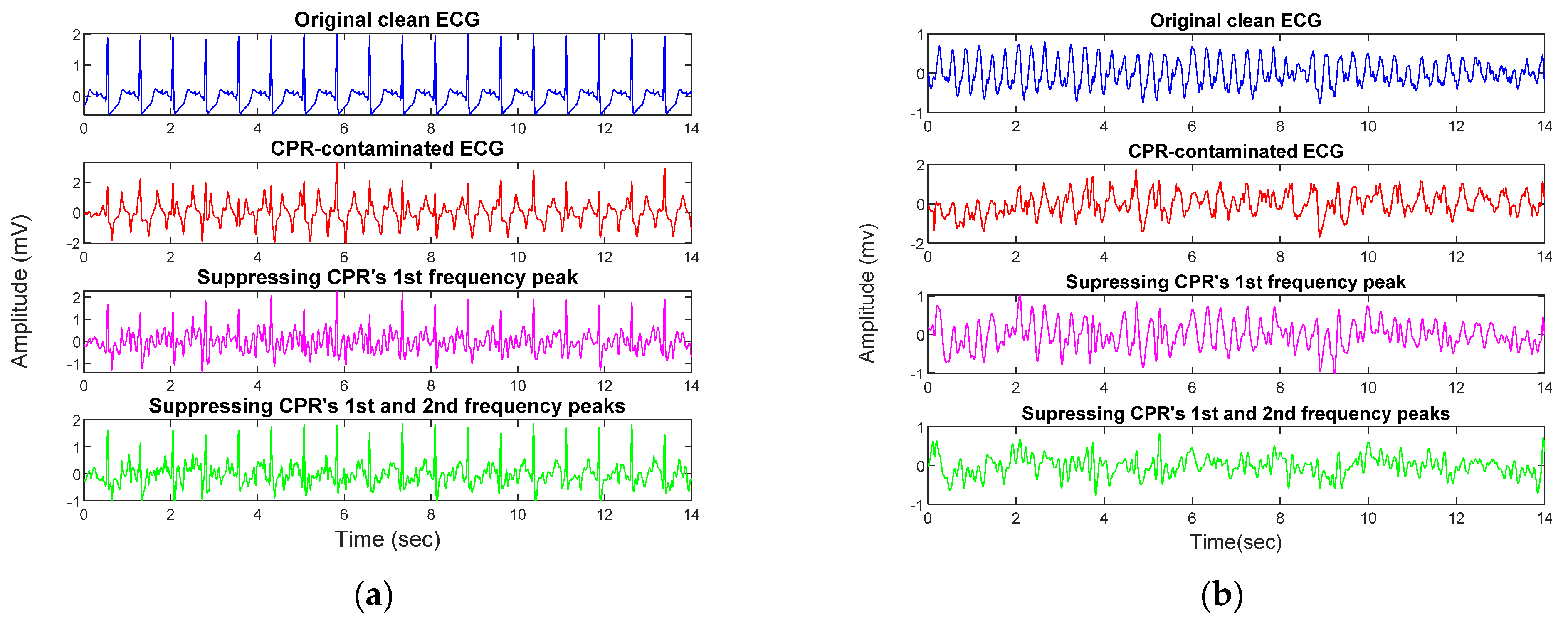 Automated Condition-Based Suppression of the CPR Artifact in ECG Data ...