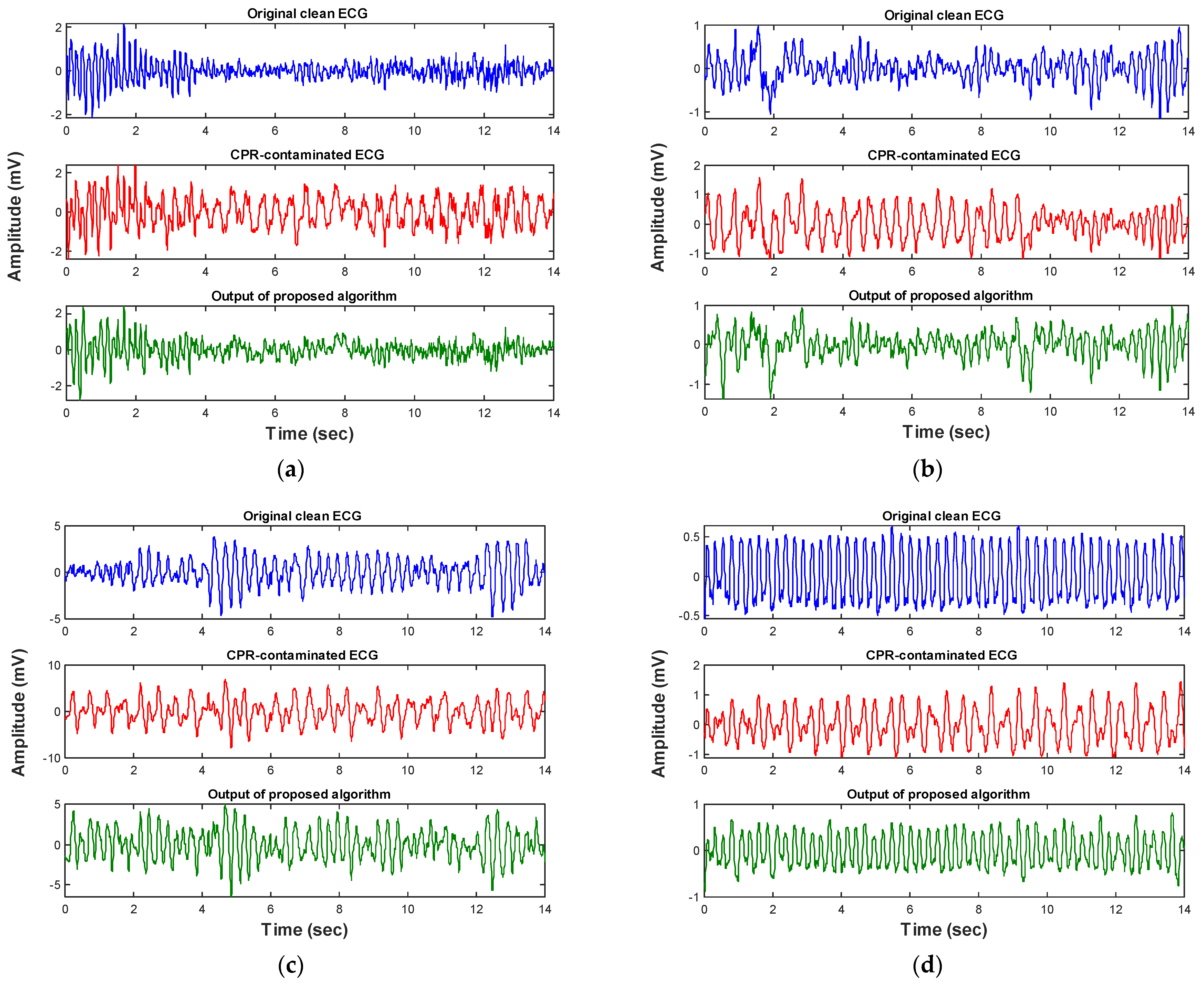 Automated Condition-Based Suppression of the CPR Artifact in ECG Data ...