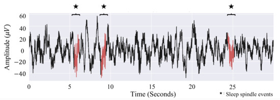 Effect of a Recliner Chair with Rocking Motions on Sleep Efficiency