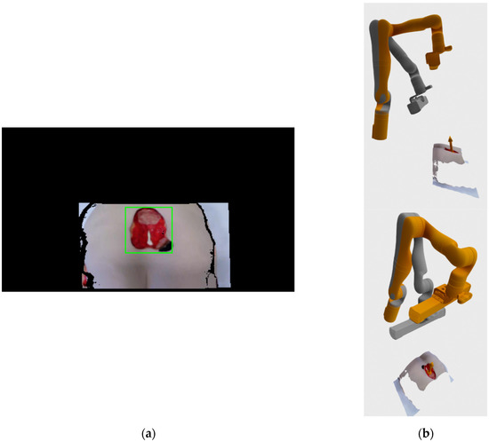 Automatic Robot-Driven 3D Reconstruction System for Chronic Wounds