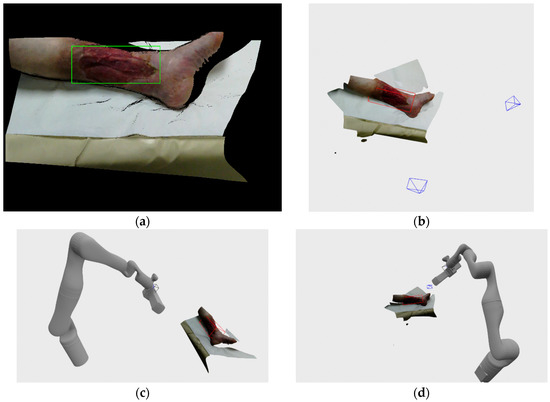 Automatic Robot-Driven 3D Reconstruction System for Chronic Wounds