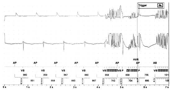 Sensors | Free Full-Text | Perioperative Sensor and Algorithm ...