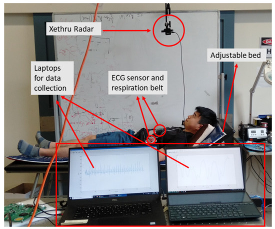 Accurate Heart Rate and Respiration Rate Detection Based on a Higher ...