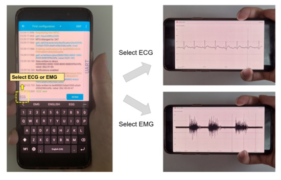 A Real-Time Wearable Physiological Monitoring System for Home-Based ...