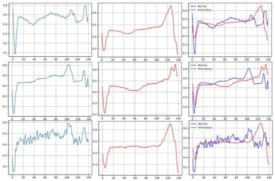 Sensors | Free Full-Text | Attention Autoencoder for Generative Latent Representational Learning ...