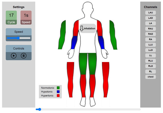 Multi-Channel Bioimpedance System for Detecting Vascular Tone in Human ...