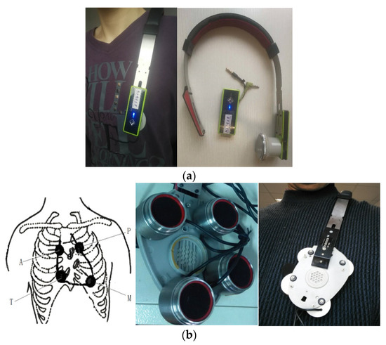 Analysis of Heart-Sound Characteristics during Motion Based on a ...