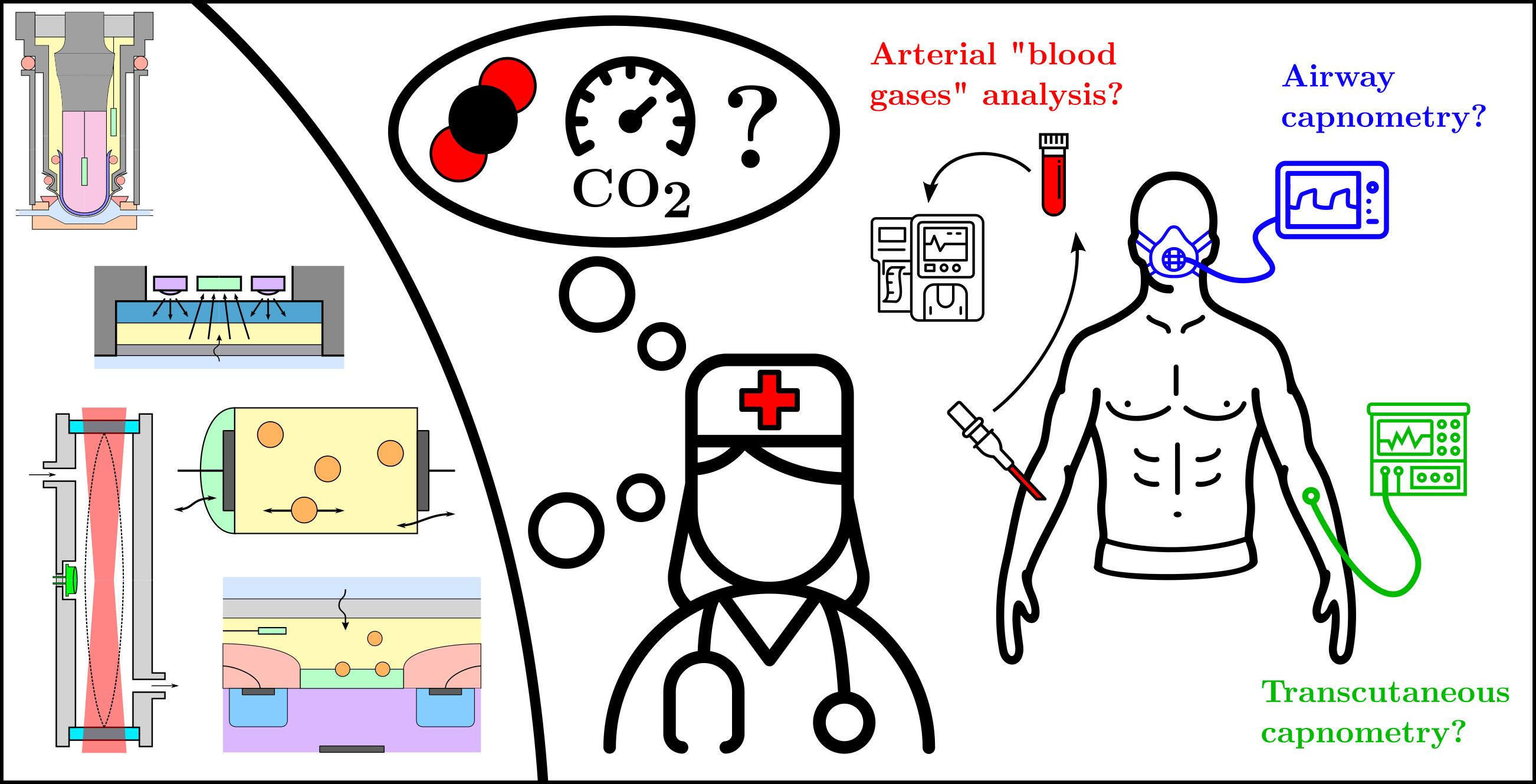 Sensors | Free Full-Text | Carbon Dioxide Sensing—Biomedical ...