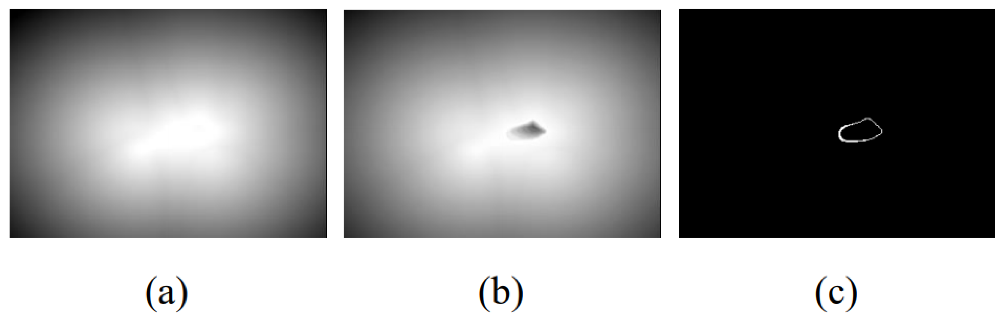 Sensors | Free Full-Text | Two-Stage Segmentation Framework Based on ...