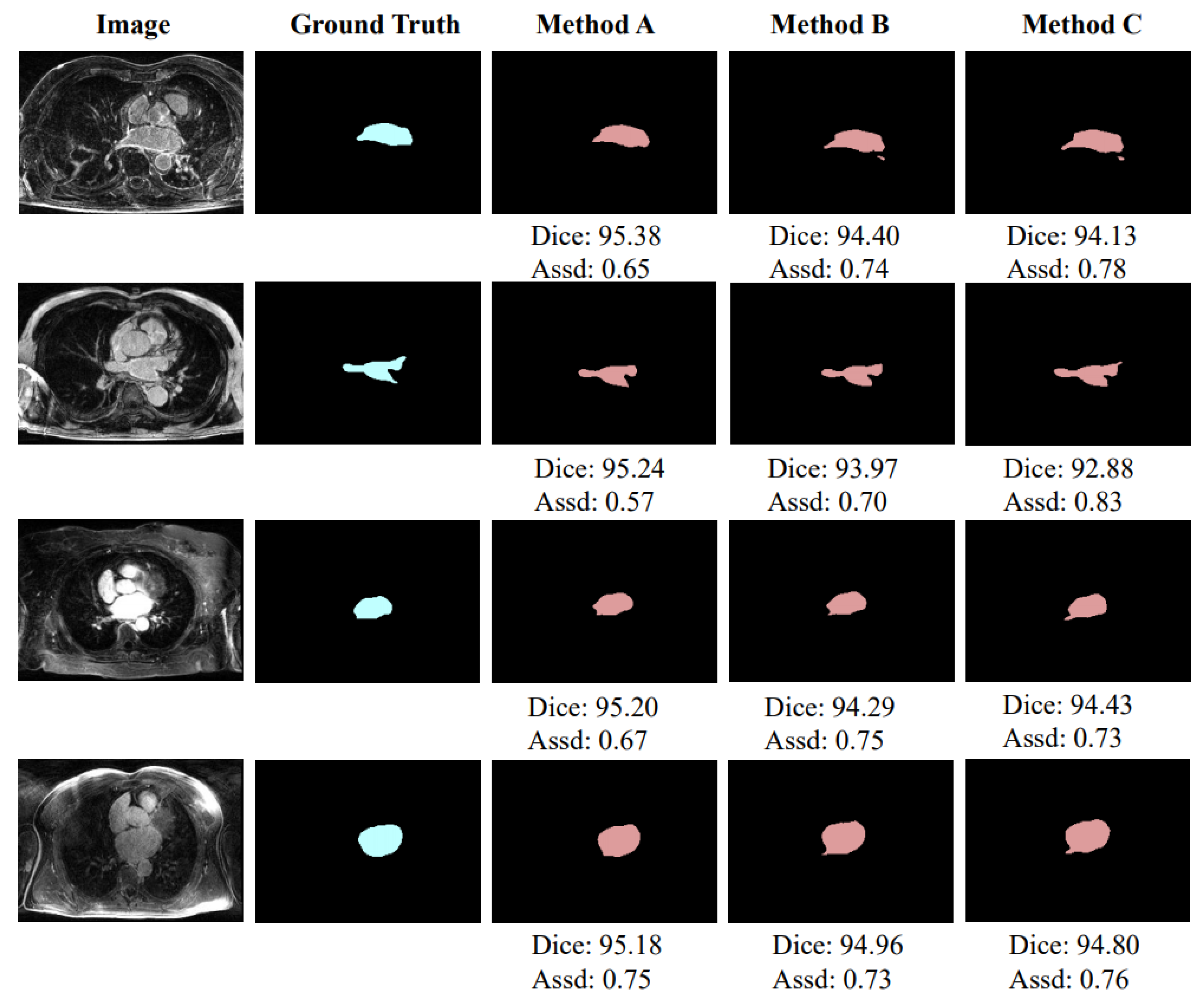 Two-Stage Segmentation Framework Based on Distance Transformation