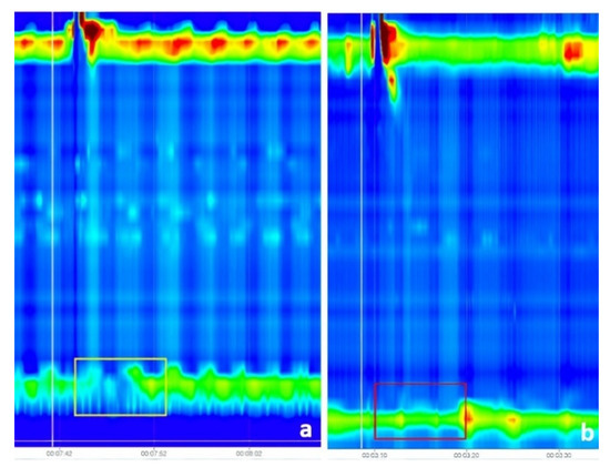 Integrated Relaxation Pressure Classification and Probe Positioning ...