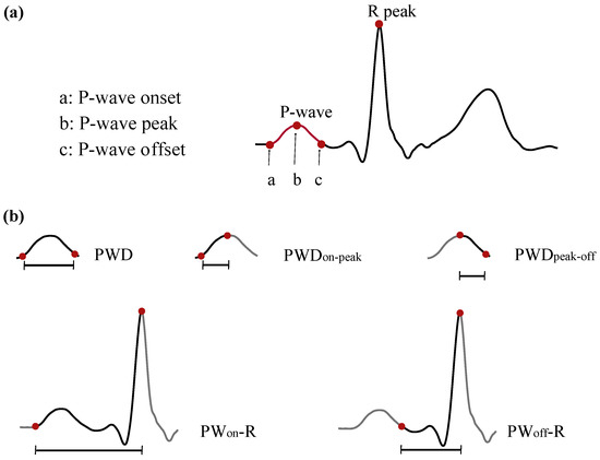 Sensors | Free Full-Text | Splitting the P-Wave: Improved Evaluation of ...