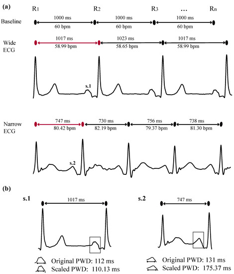 Sensors | Free Full-Text | Splitting the P-Wave: Improved Evaluation of ...