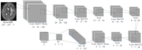 Sensors | Free Full-Text | Brain Tumor/Mass Classification Framework Using Magnetic-Resonance ...