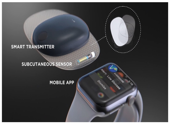 Comprehensive Review on Wearable Sweat-Glucose Sensors for Continuous ...