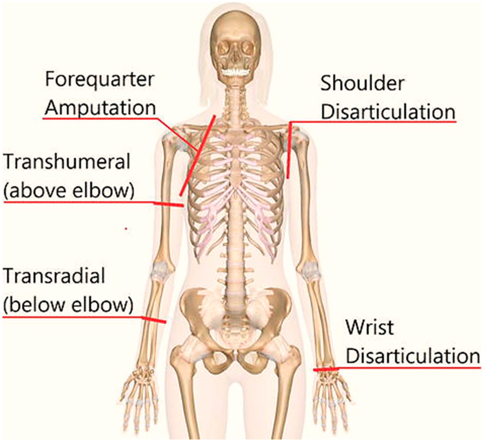 fNIRS-Based Upper Limb Motion Intention Recognition Using an Artificial Neural Network for ...