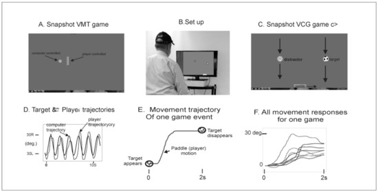 Sensors | Free Full-Text | Game-Based Dual-Task Exercise Program for ...