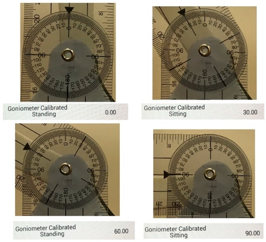 A 3D-Printed Knee Wearable Goniometer with a Mobile-App Interface for ...
