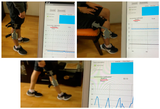 A 3D-Printed Knee Wearable Goniometer with a Mobile-App Interface for ...