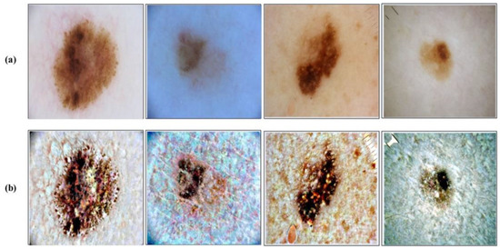 Sensors | Free Full-Text | Multiclass Skin Lesion Classification Using ...