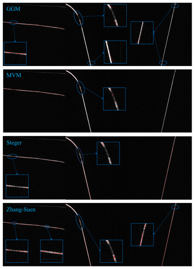 Laser Curve Extraction of Wheelset Based on Deep Learning Skeleton ...