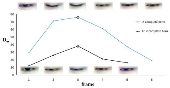Evaluation of VDT-Induced Visual Fatigue by Automatic Detection of ...