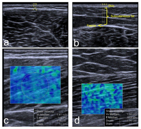 The Association between Tensiomyography and Elastography Stiffness ...