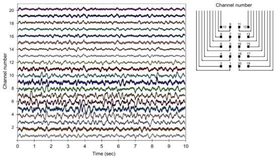 An Inkjet Printed Flexible Electrocorticography (ECoG) Microelectrode ...