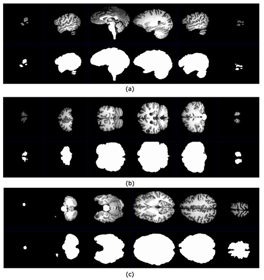 Hyperconnected Openings Codified in a Max Tree Structure: An ...