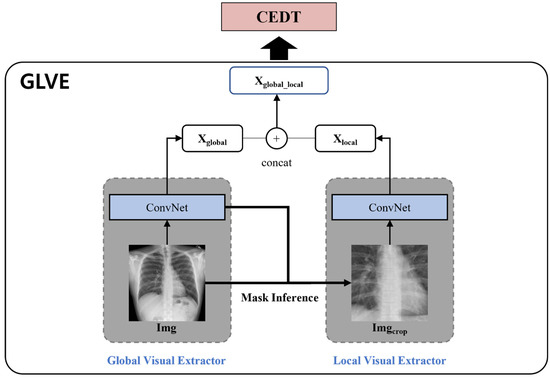Cross Encoder-Decoder Transformer with Global-Local Visual Extractor ...
