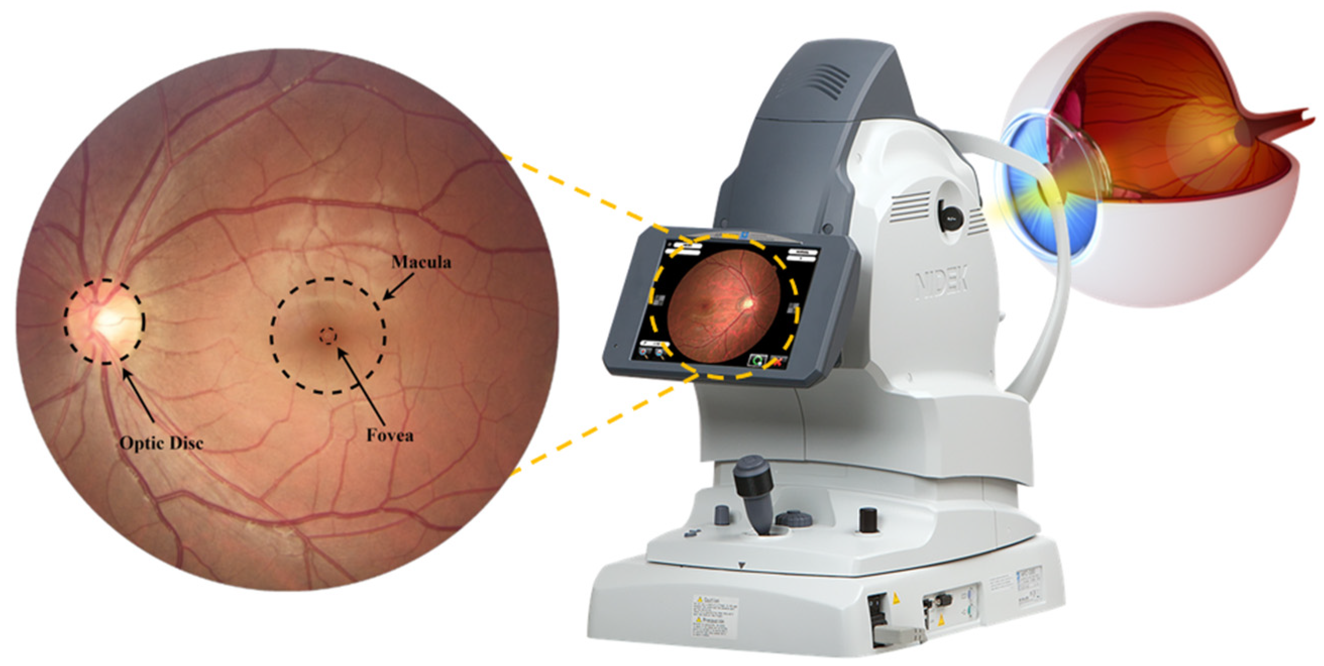 Evaluations of Deep Learning Approaches for Glaucoma Screening Using ...