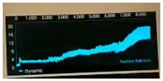 Continuous Lactate Monitoring System Based on Percutaneous Microneedle ...