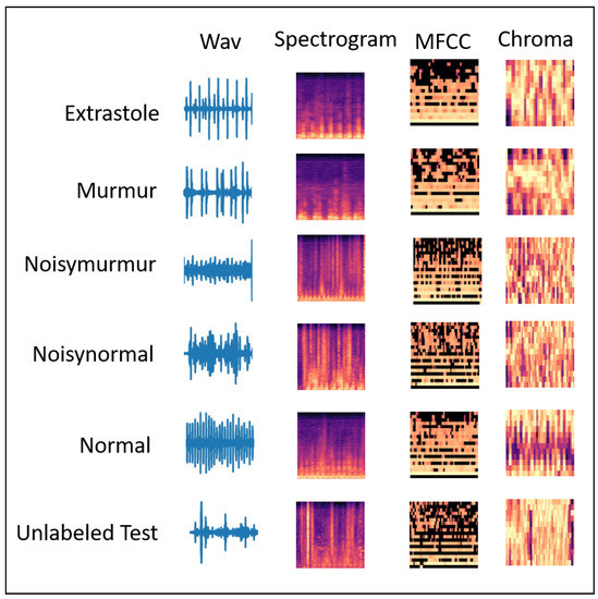 Feature-Based Fusion Using CNN for Lung and Heart Sound Classification