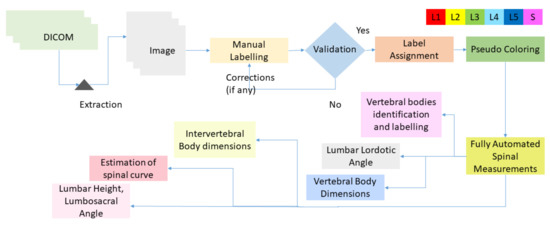 Localization and Edge-Based Segmentation of Lumbar Spine Vertebrae to ...